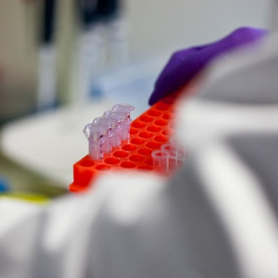 Human Biomonitoring Research Unit » Luxembourg Institute of Health