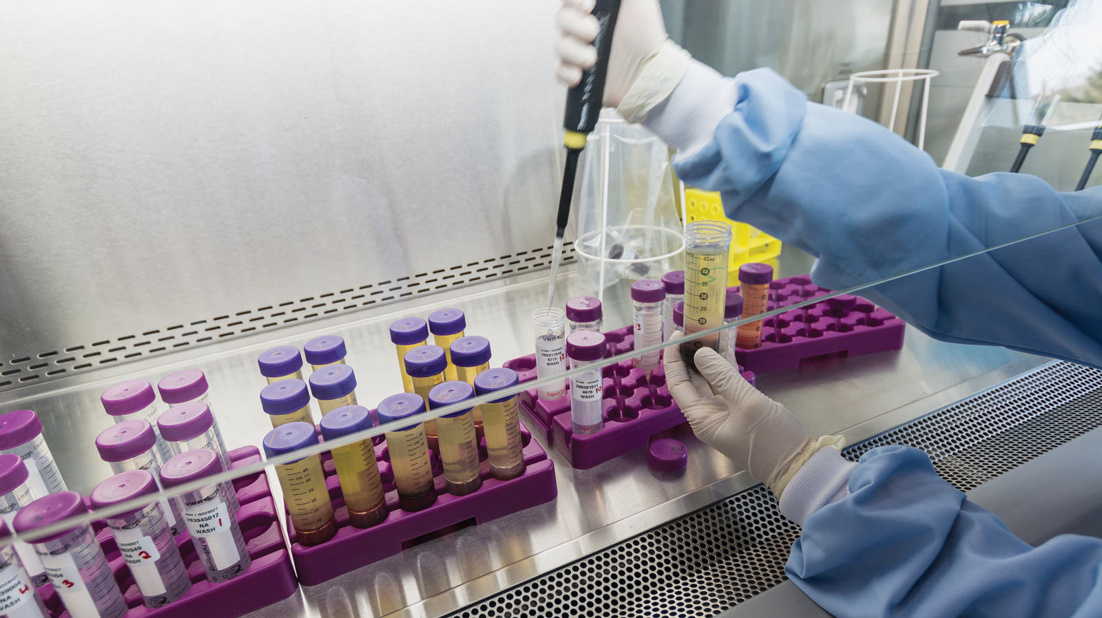 Integrated Biobank of Luxembourg (IBBL) » Luxembourg Institute of Health