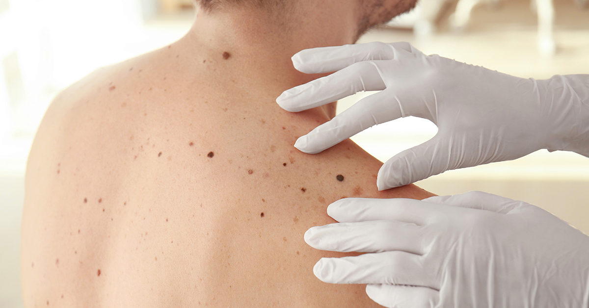 A new breakthrough in cancer treatment » Luxembourg Institute of Health