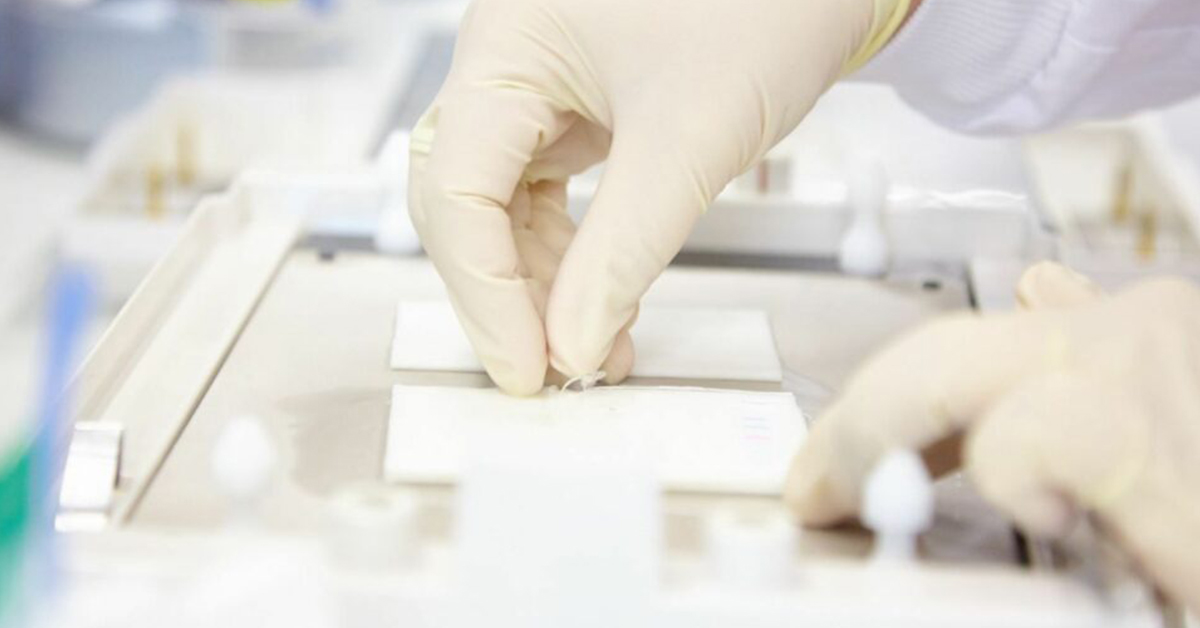 LIH shapes the future of translational allergy research » Luxembourg ...