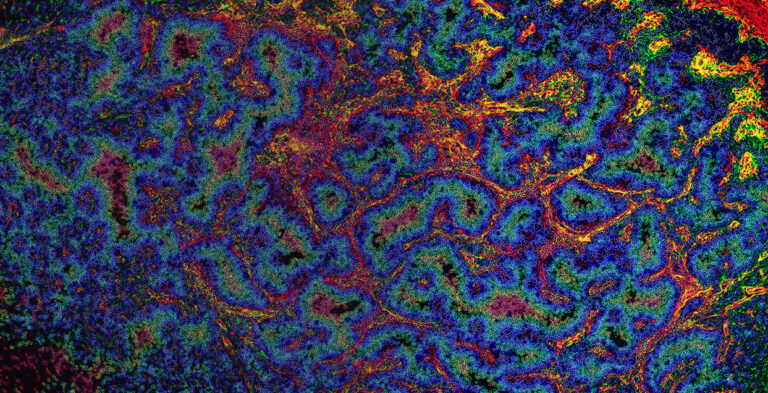 Translational Cancer Immunogenomics » Luxembourg Institute of Health